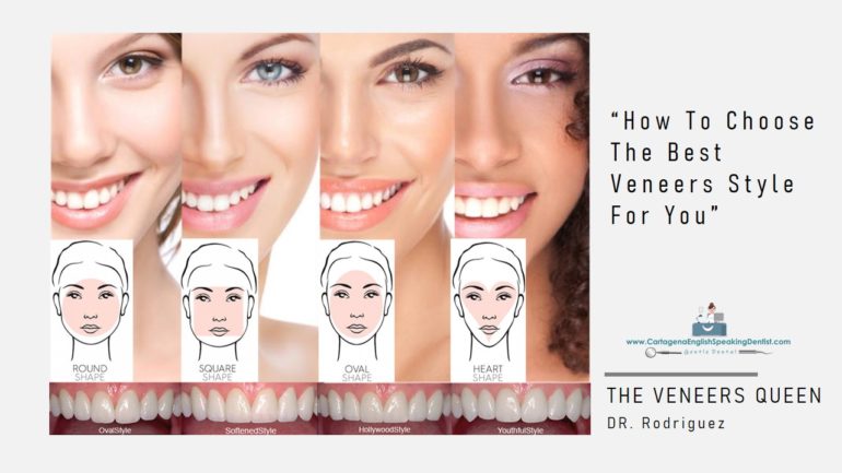 CHOOSING THE RIGHT SHAPE VENEERS ⋆ Cartagena English